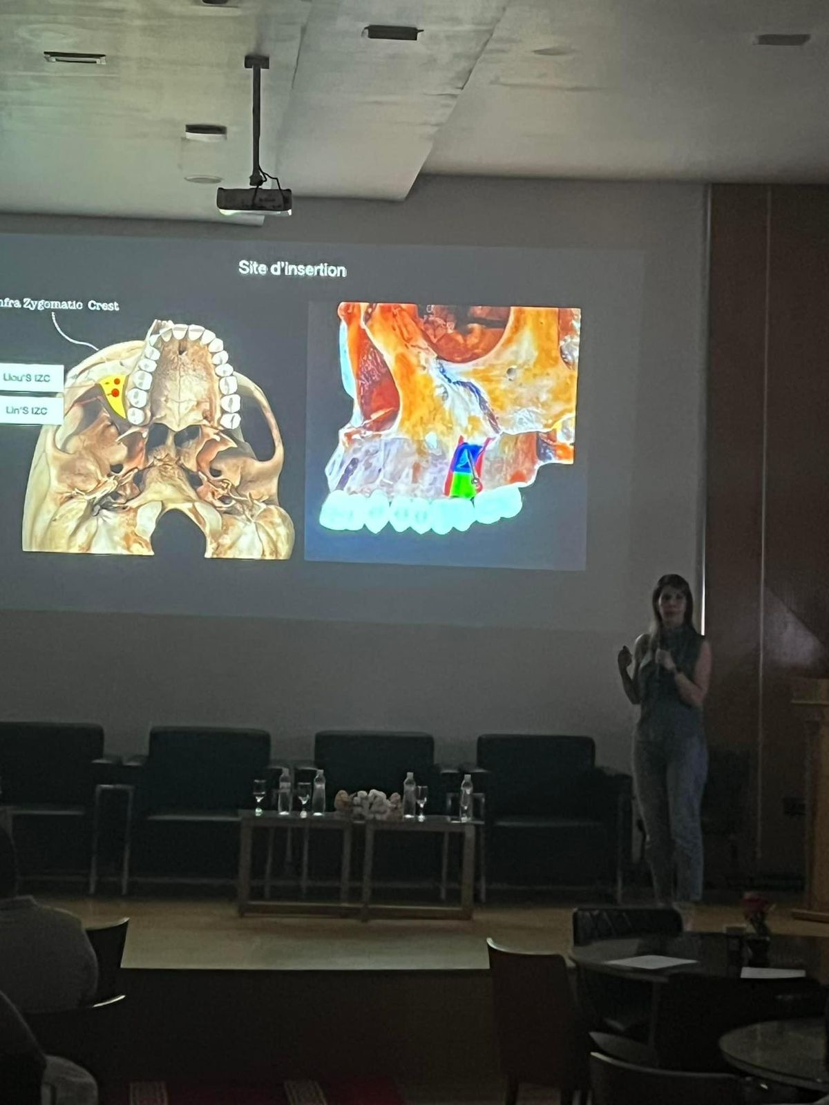 Explorez les Secrets des Mini-Vis en Orthodontie avec Dr Amina